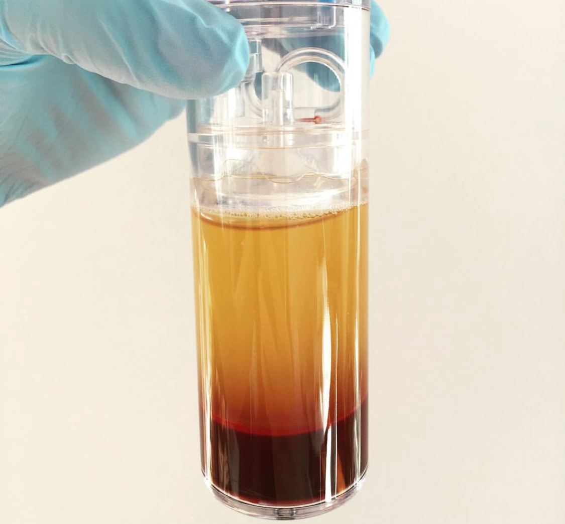 What is Platelet Rich Plasma (PRP)? – PRP Training